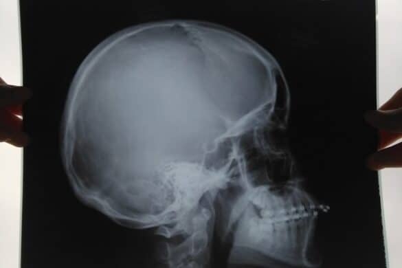 Tomato Plant Allergy Rash: Symptoms, Causes, and Treatment - Life ...